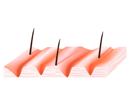 Effektive råd og behandlingstips til xerose den almindelige tilstand a