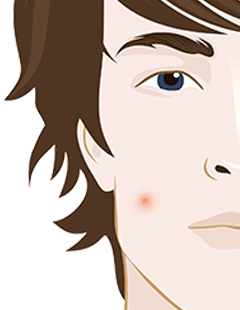 Bylder kræver behandling → Se hvad du skal gøre her